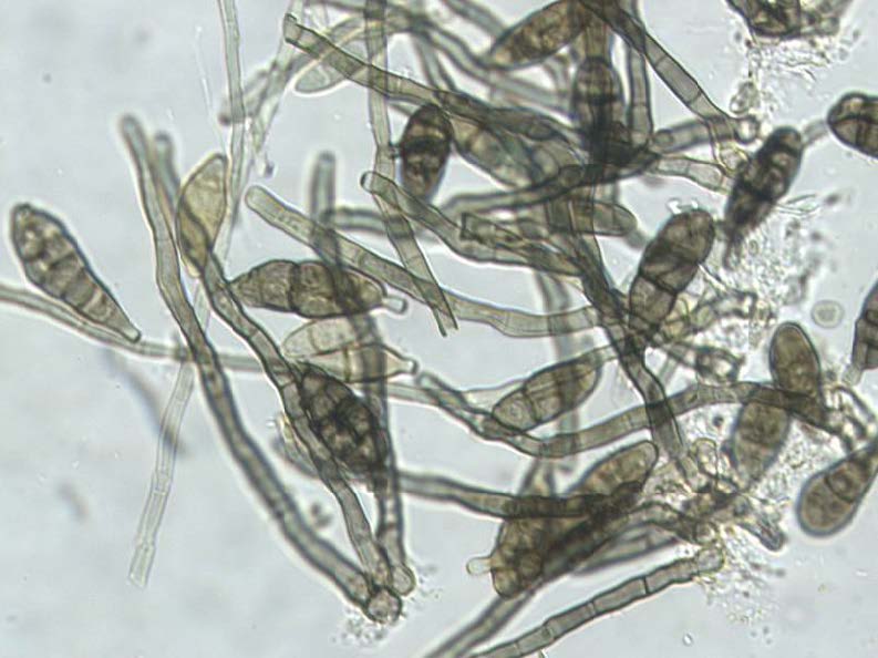 News: Diagnostics of seed borne pathogens of rice, January 2016 - The ...